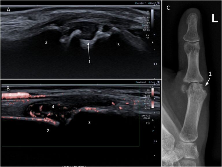 Hand and Wrist Ultrasound – London Ultrasound Clinic